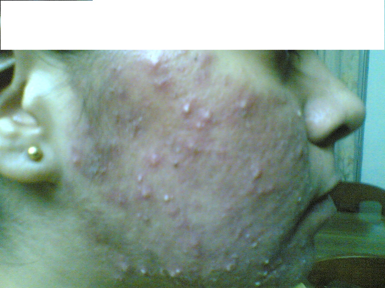 Dr. Ashima Goel, Dermatologist - Parisa Skin Cosmetic and Laser Centre ...